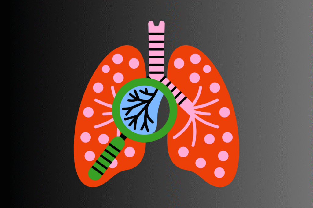 Bronchiolitis Ayurveda: Types, Causes, Symptoms & Treatment