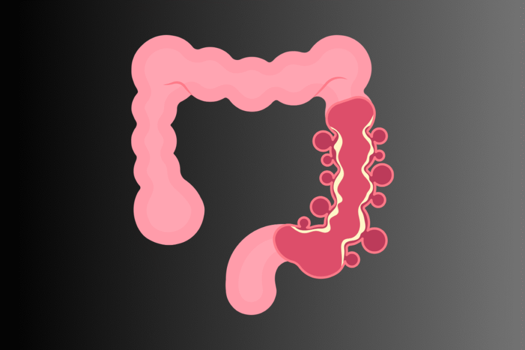 IBS Ayurveda: Types, Causes, Symptoms & Treatment
